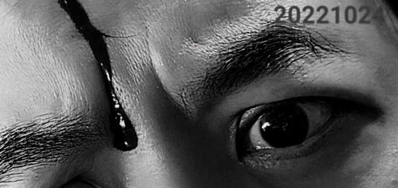 黃子佼「頭破血流」不敢告訴老婆！自嘲：浴血奮戰的一天 | 娛樂 | NOWnews今日新聞